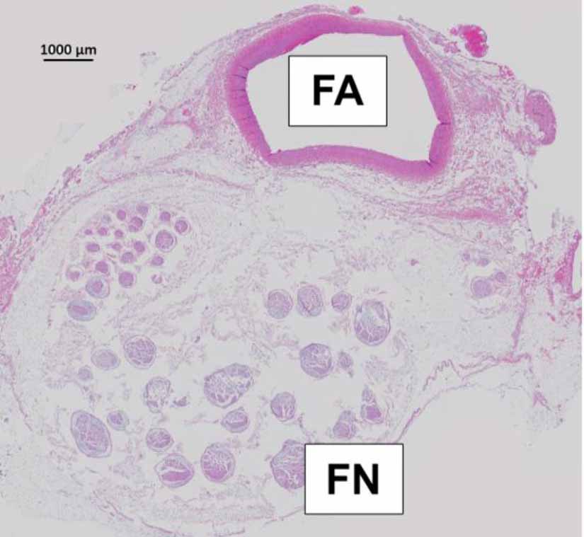 Feasibility of endovascular stimulation of the femoral nerve using a ...