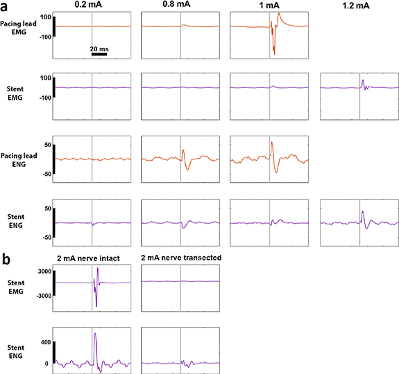 Feasibility of endovascular stimulation of the femoral nerve using a ...