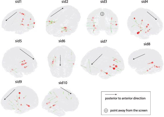 Speech decoding from stereo-electroencephalography (sEEG) signals using ...