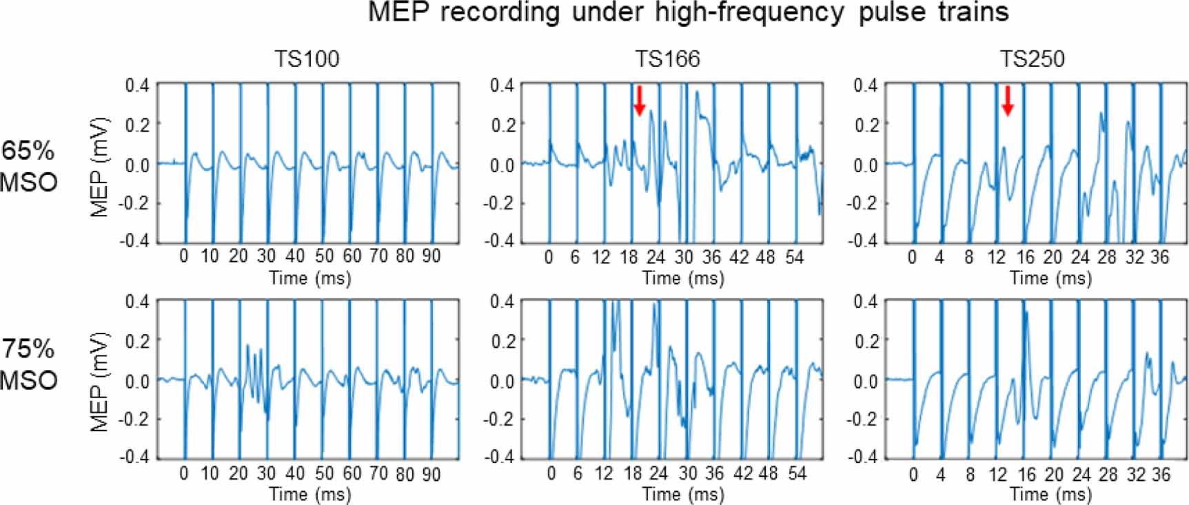 Ultra-high frequency repetitive TMS at subthreshold intensity induces ...