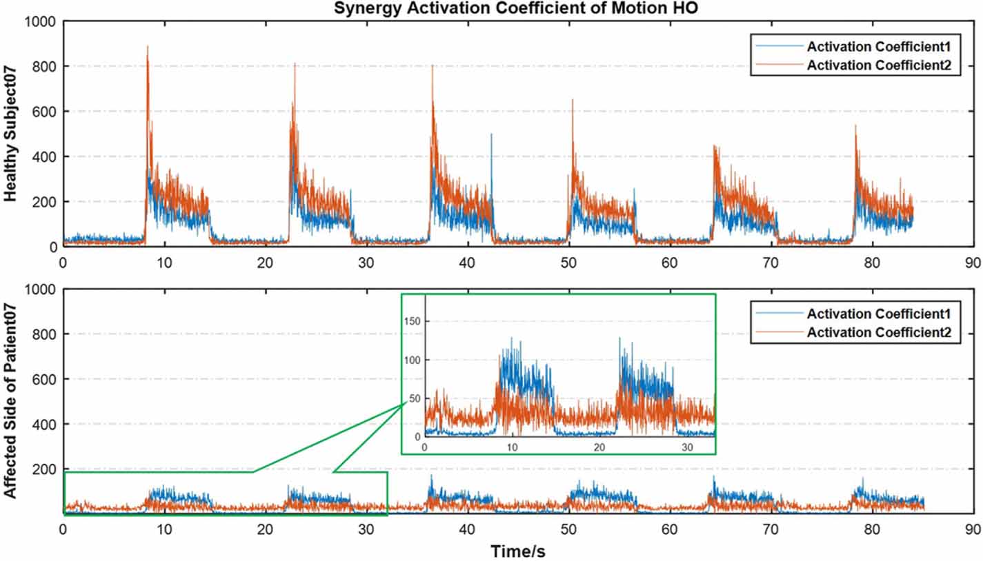 Characterizing upper limb motor dysfunction with temporal and spatial ...