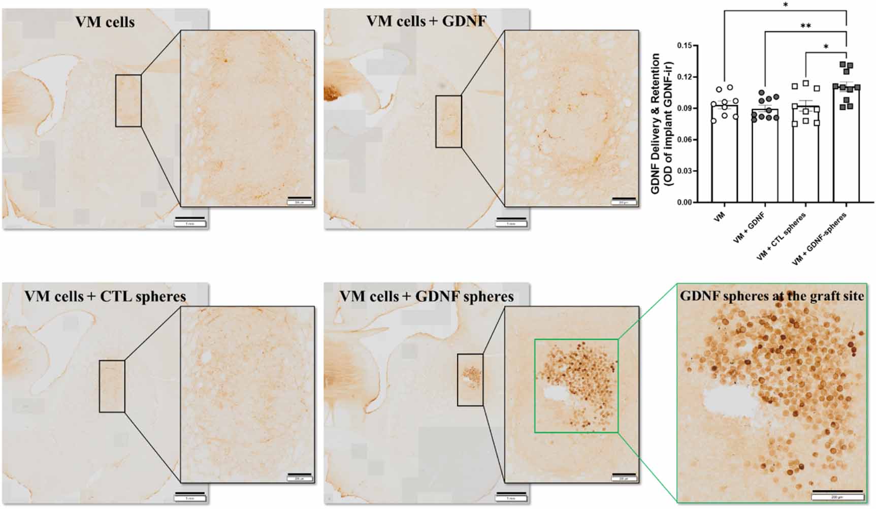 Cryogel microcarriers loaded with glial cell line-derived neurotrophic ...