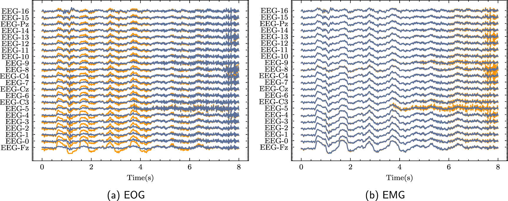 Integrating spatial and temporal features for enhanced artifact removal ...