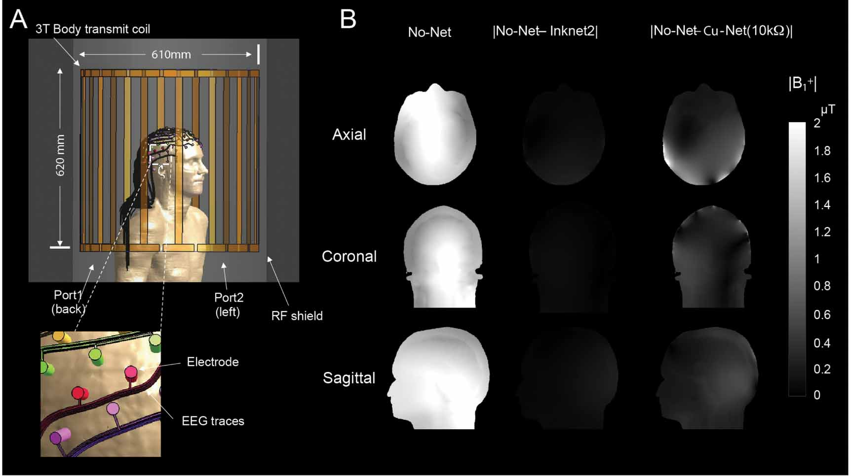 High-quality multimodal MRI with simultaneous EEG using conductive ink ...