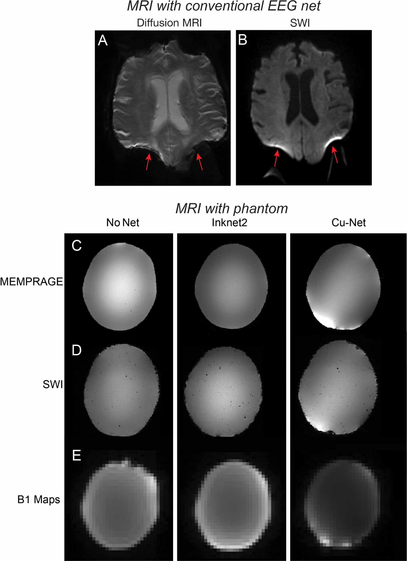 High-quality multimodal MRI with simultaneous EEG using conductive ink ...