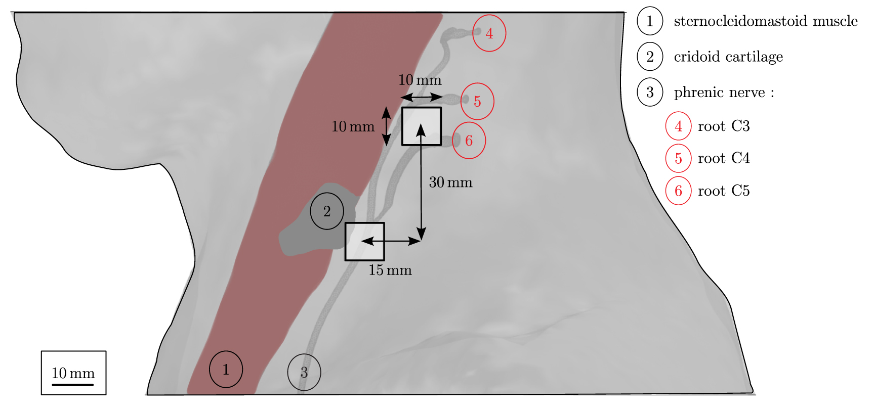Activation thresholds for electrical phrenic nerve stimulation at the ...