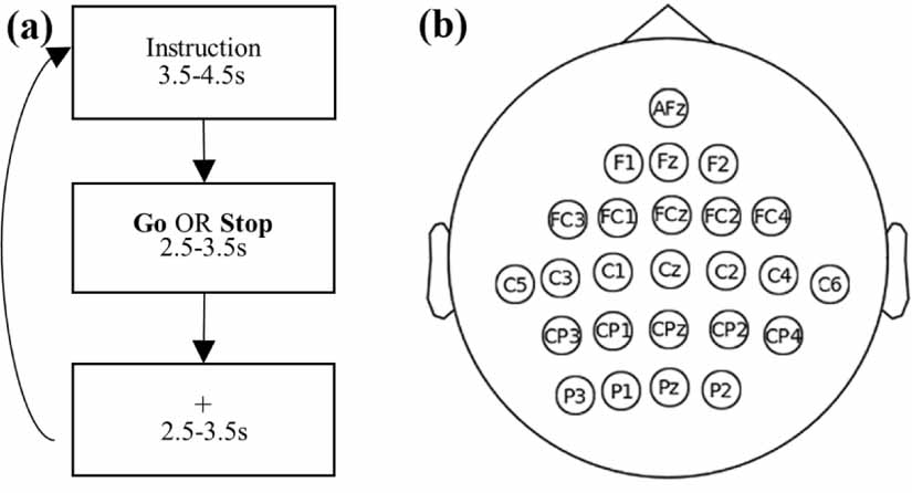 Decoding imagined movement in people with multiple sclerosis for brain ...