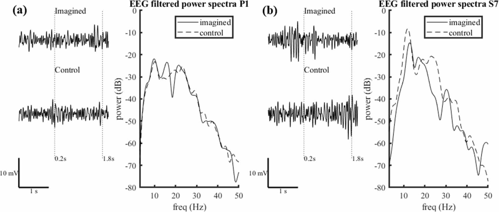 Decoding imagined movement in people with multiple sclerosis for brain ...