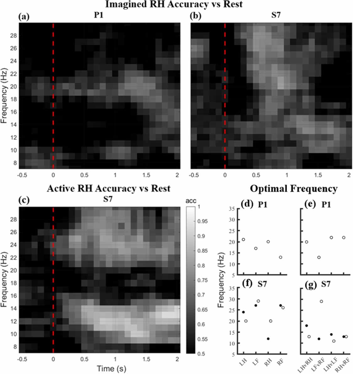 Decoding imagined movement in people with multiple sclerosis for brain ...