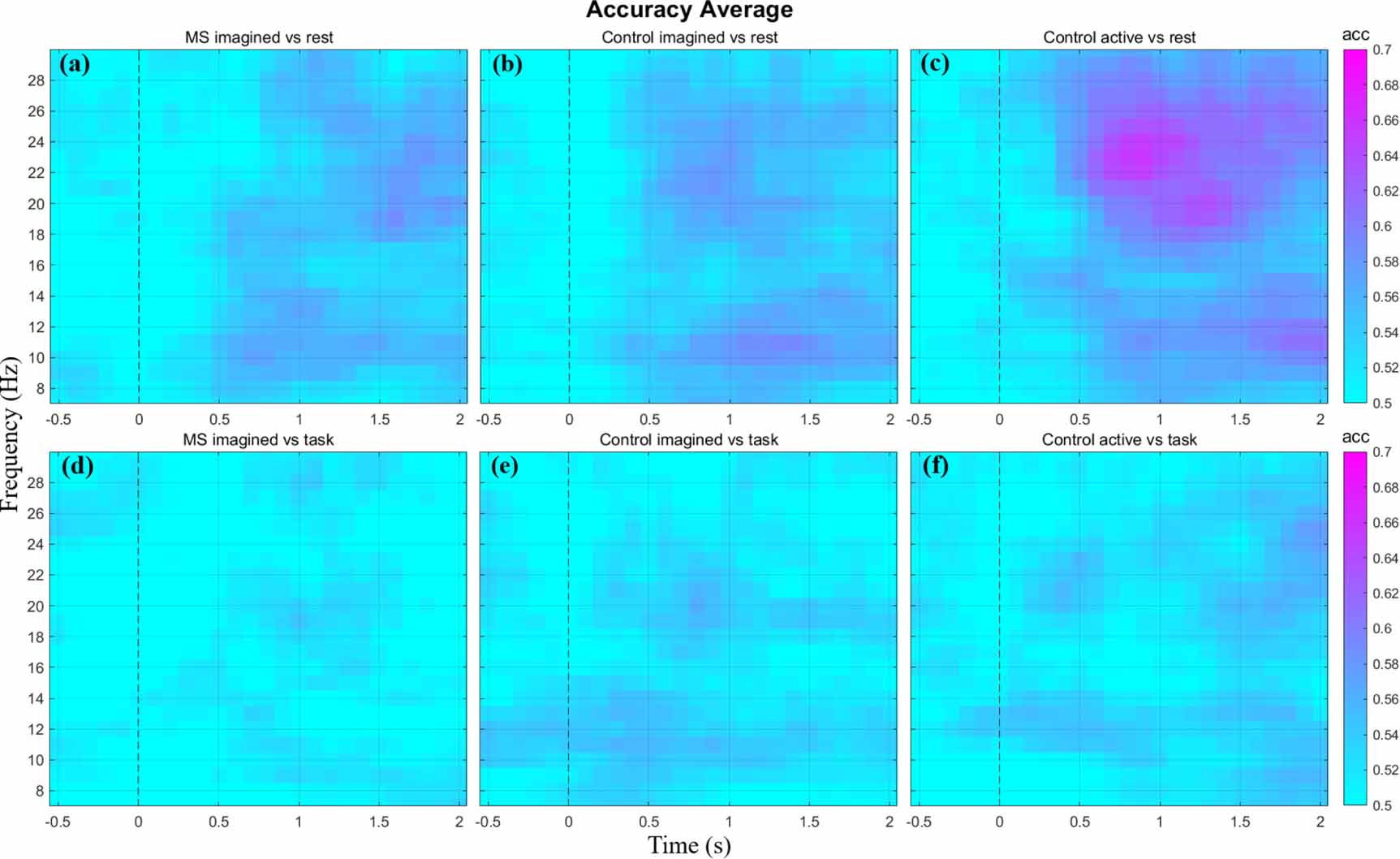 Decoding imagined movement in people with multiple sclerosis for brain ...