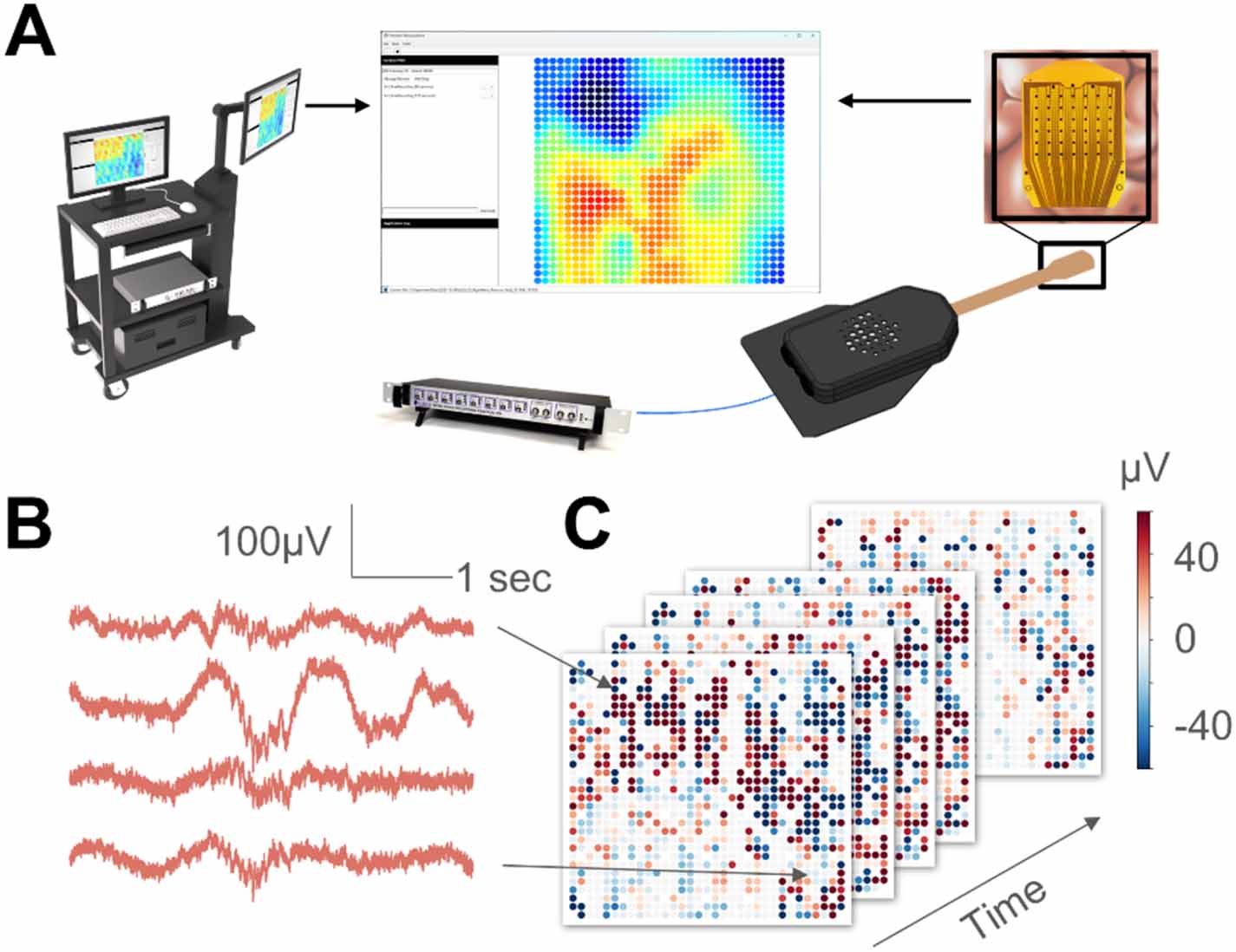 First-in-human experience performing high-resolution cortical mapping ...