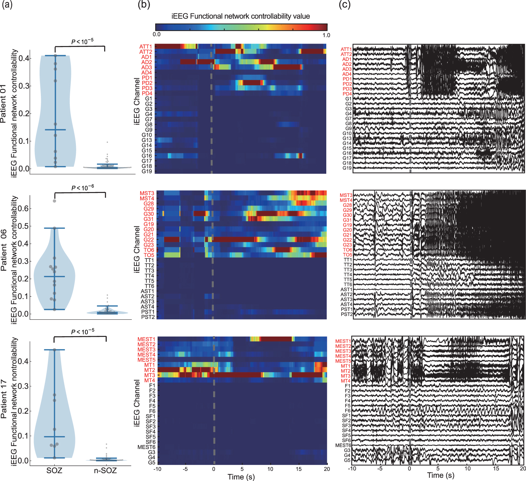 Dynamical intracranial EEG functional network controllability localizes ...