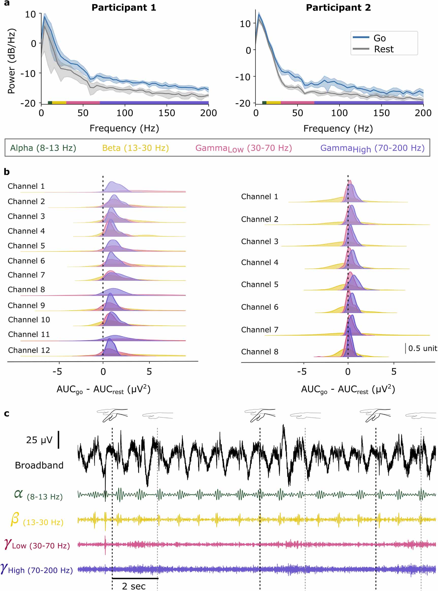 Motor activity in gamma and high gamma bands recorded with a Stentrode ...