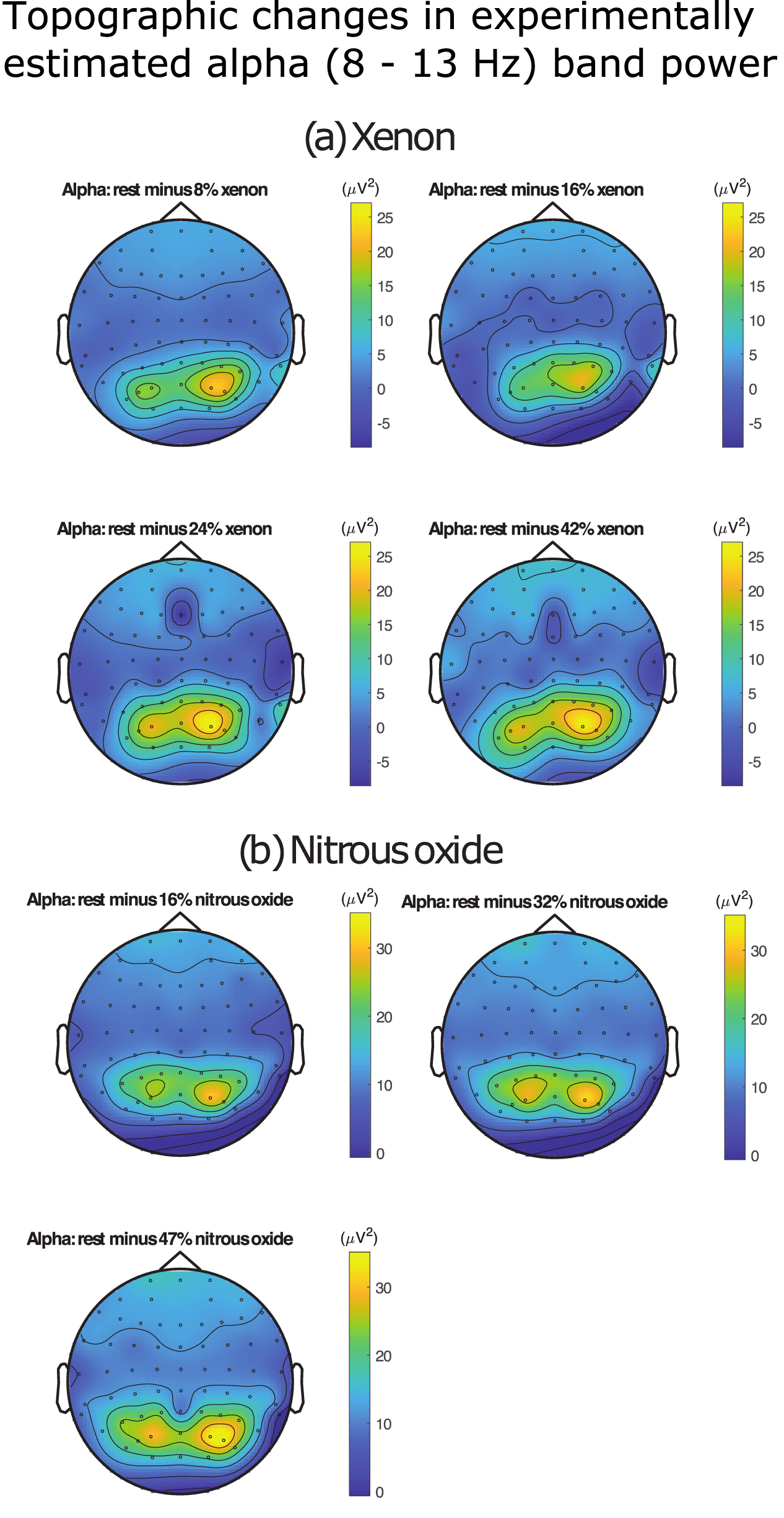 Xenon and nitrous oxide induced changes in resting EEG activity can be ...