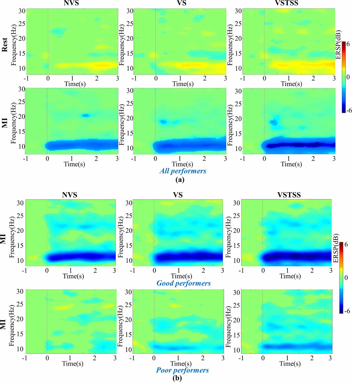 Enhancing lower-limb motor imagery using a paradigm with visual and ...