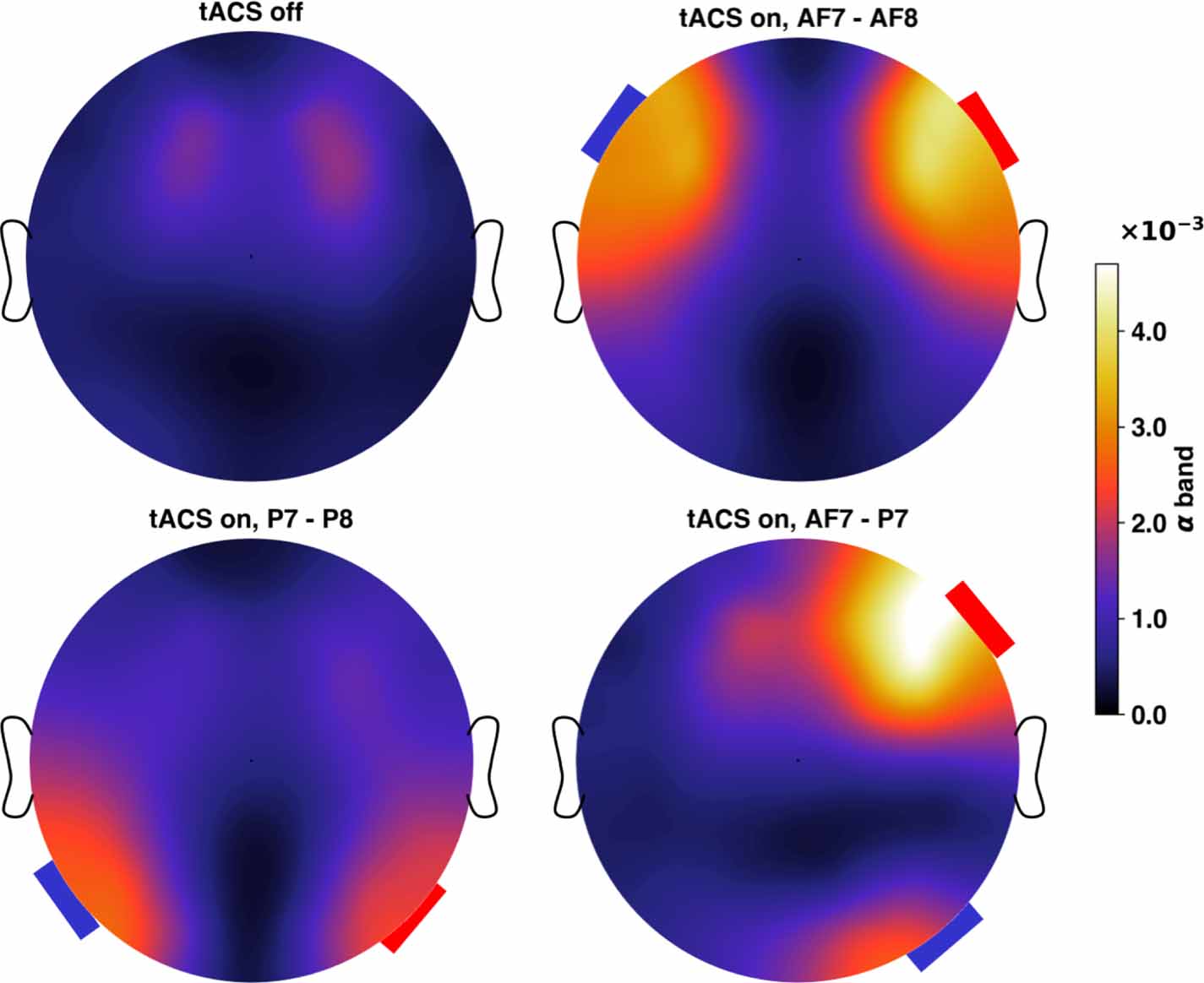 Precision non-invasive brain stimulation: an in silico pipeline for ...