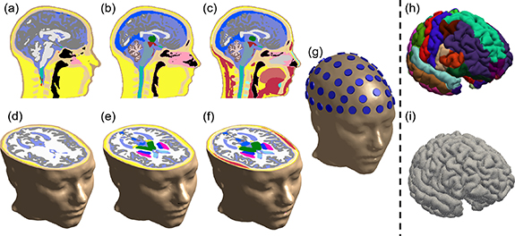 Precision non-invasive brain stimulation: an in silico pipeline for ...
