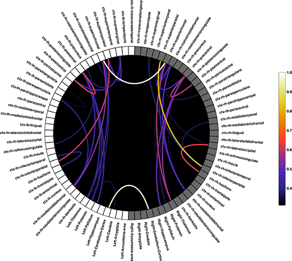 Precision non-invasive brain stimulation: an in silico pipeline for ...