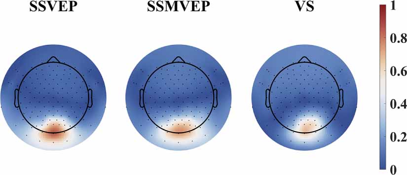 Comparisons of stimulus paradigms for SSVEP-based brain–computer ...