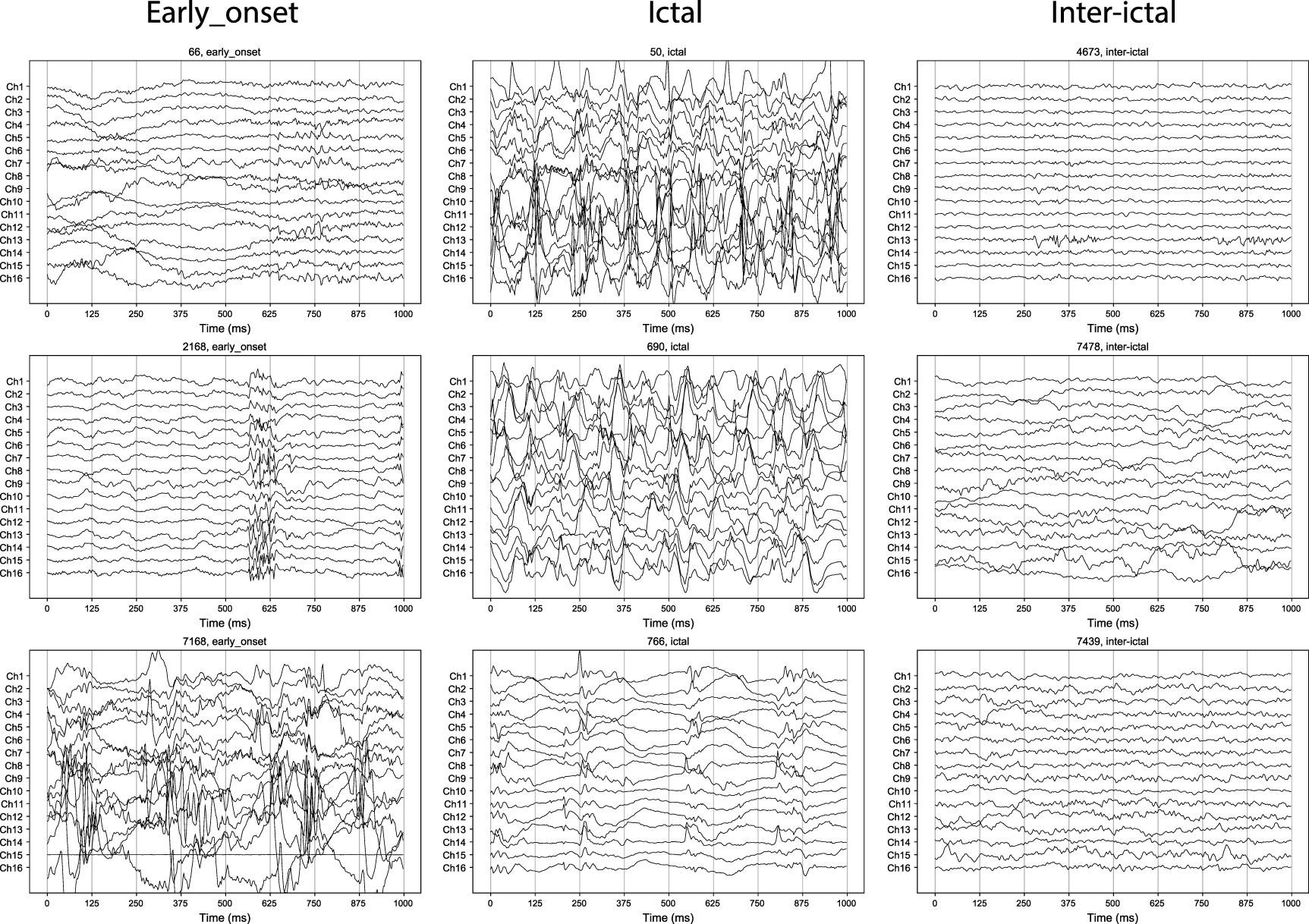 Annotating neurophysiologic data at scale with optimized human input ...