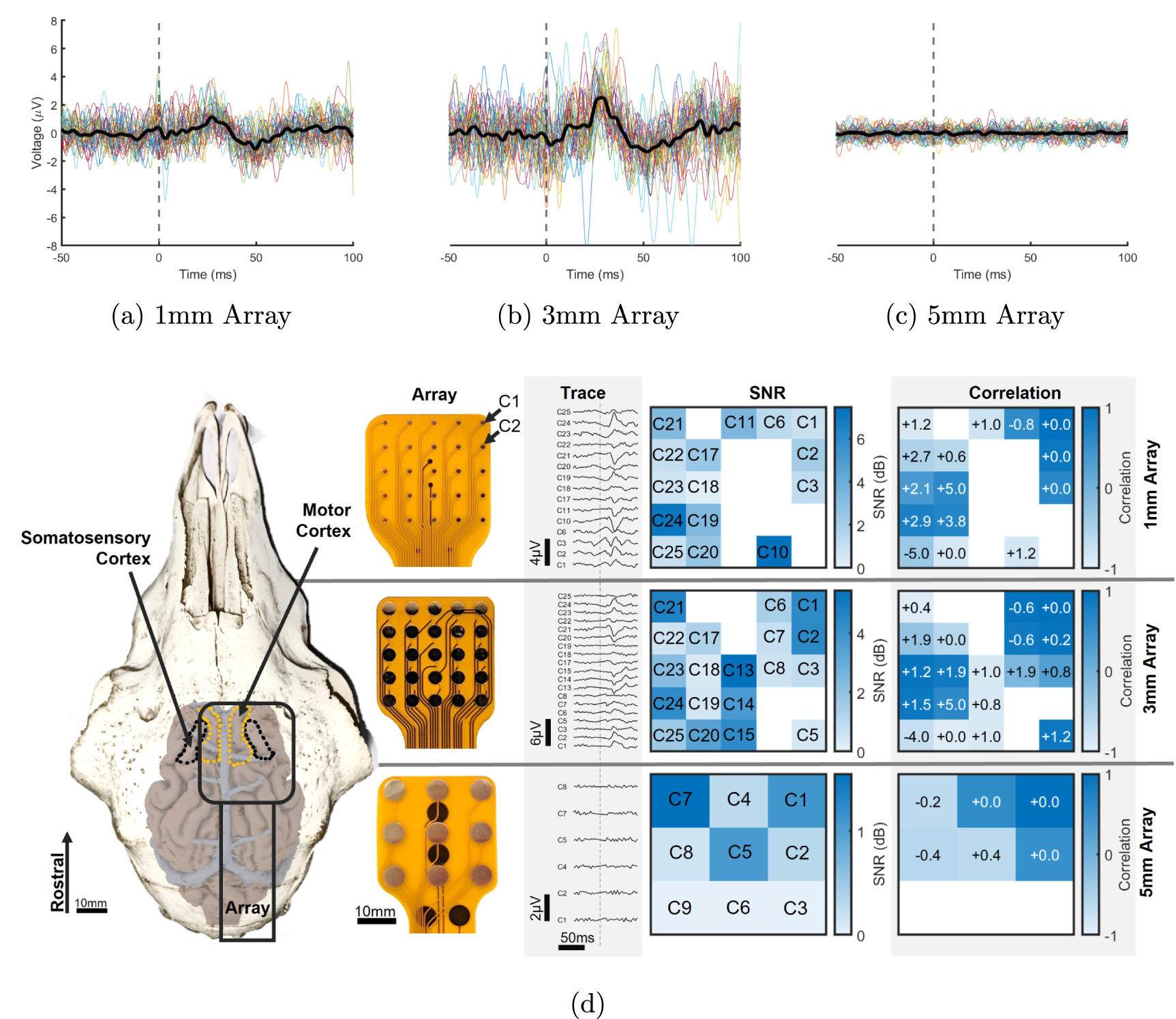 Sub-scalp EEG for sensorimotor brain–computer interface - IOPscience
