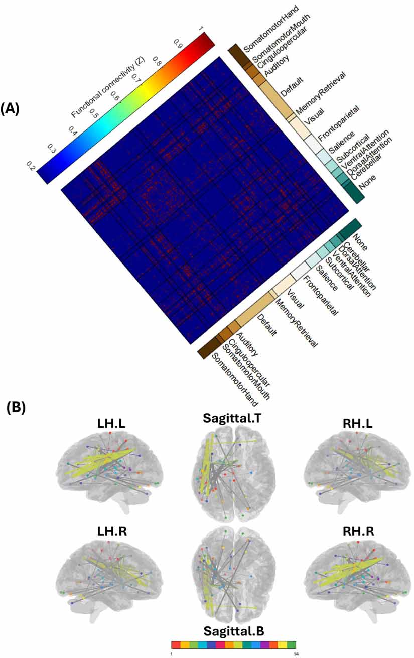 Post-stroke aphasia analysis using topological alterations in brain ...