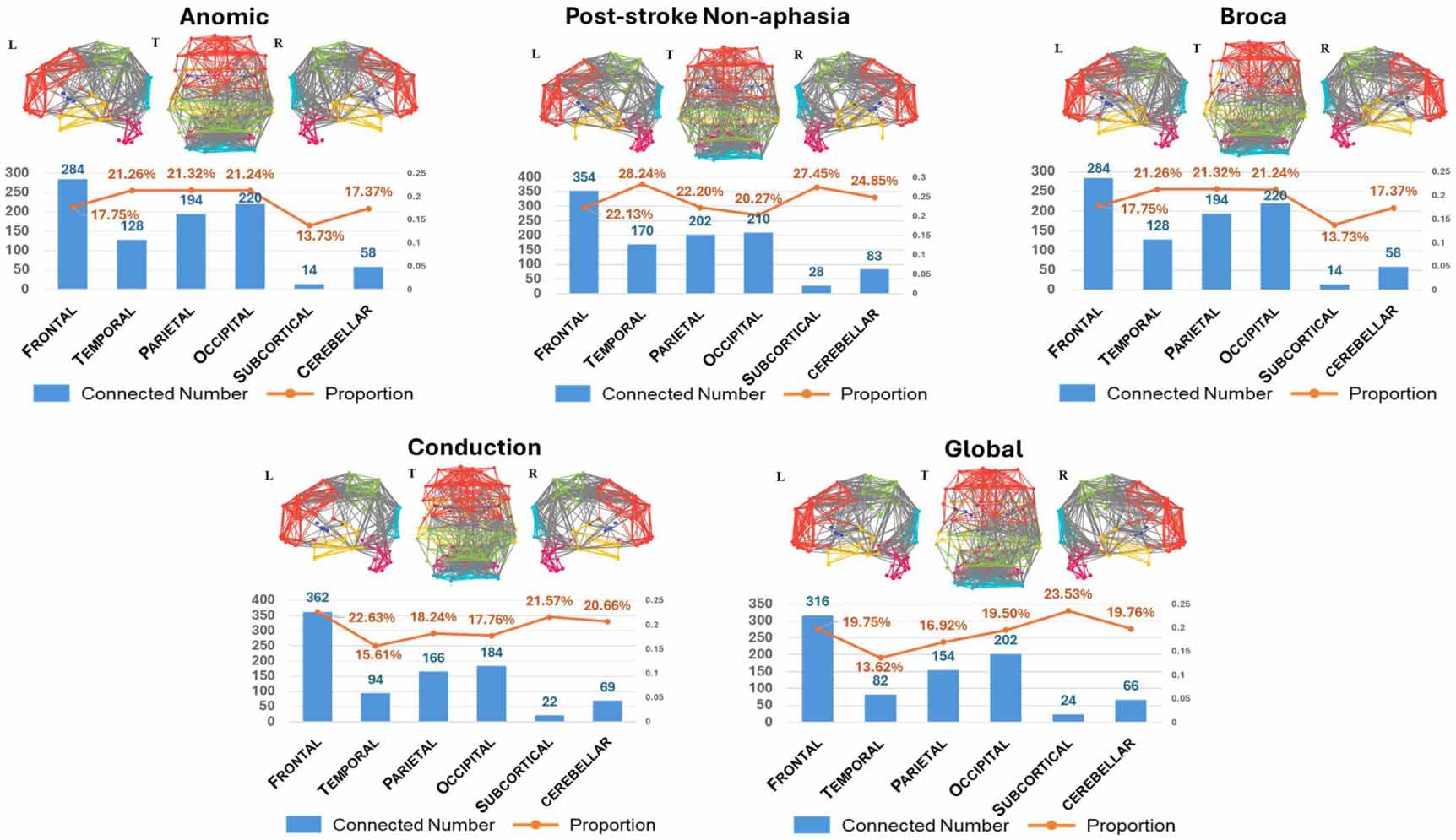 Post-stroke aphasia analysis using topological alterations in brain ...