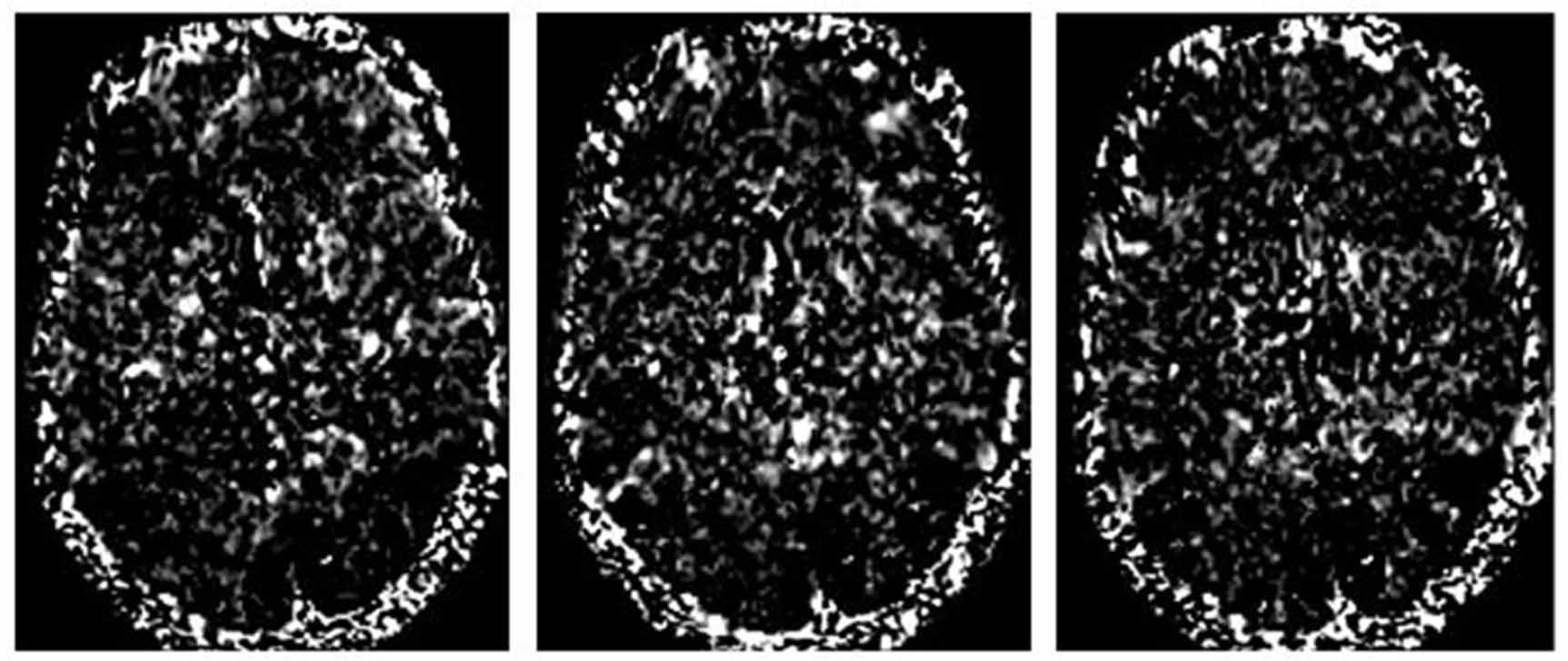 Optimized AI-based neural decoding from BOLD fMRI signal for analyzing ...