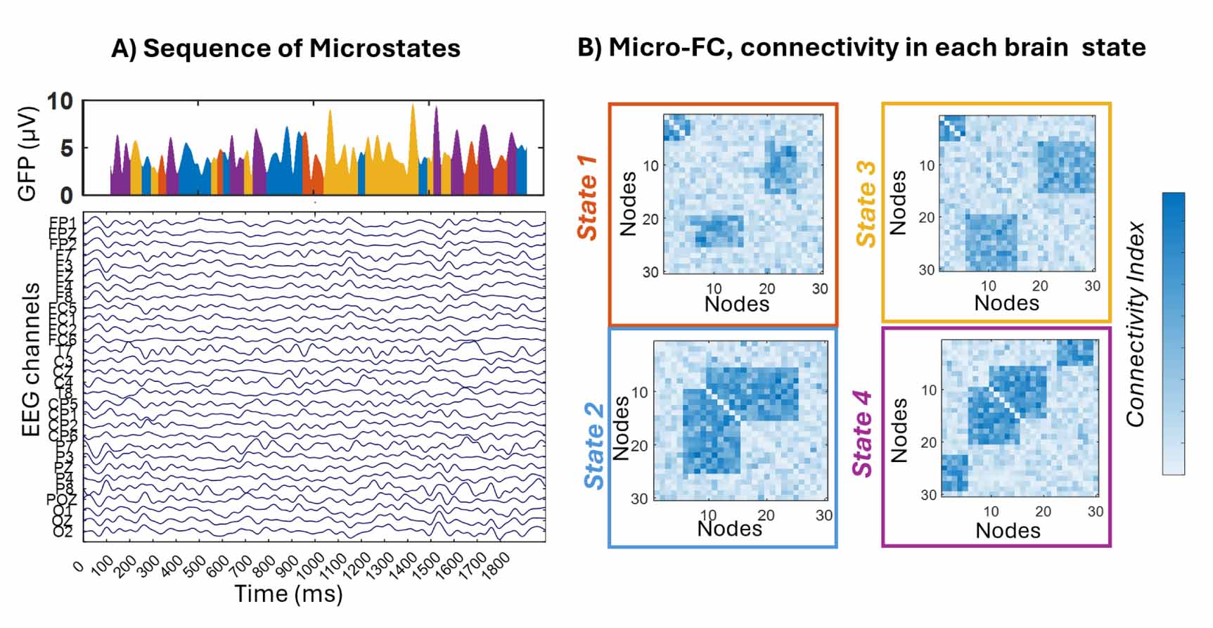 The time-varying brain: a comprehensive review of dynamic functional ...