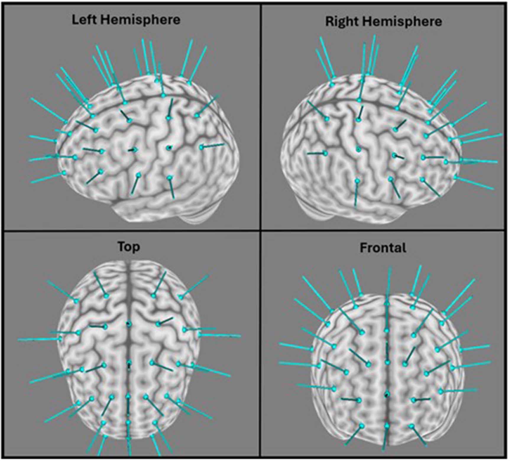 Refining signal localization: a transcranial magnetic stimulation motor ...