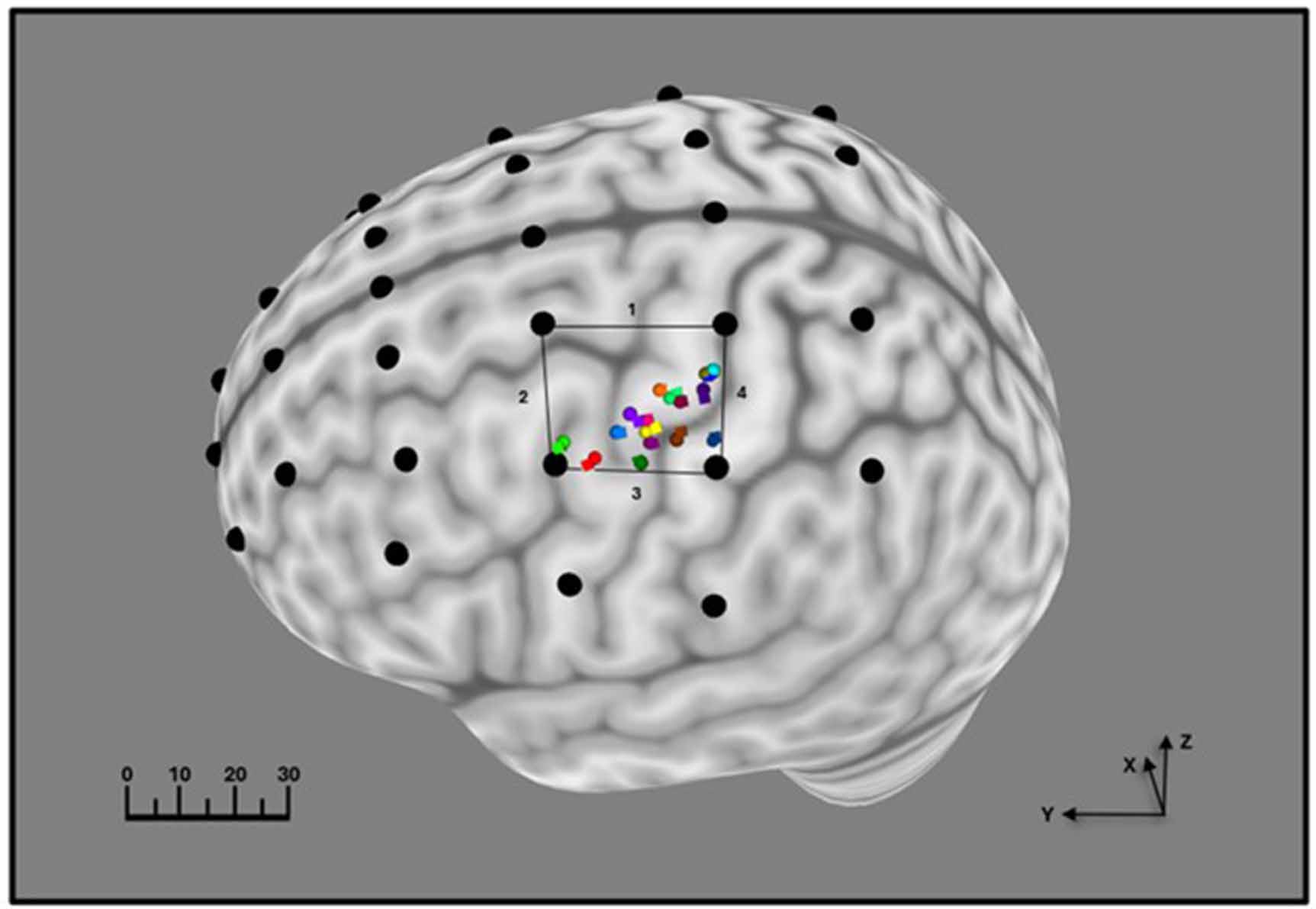 Refining signal localization: a transcranial magnetic stimulation motor ...