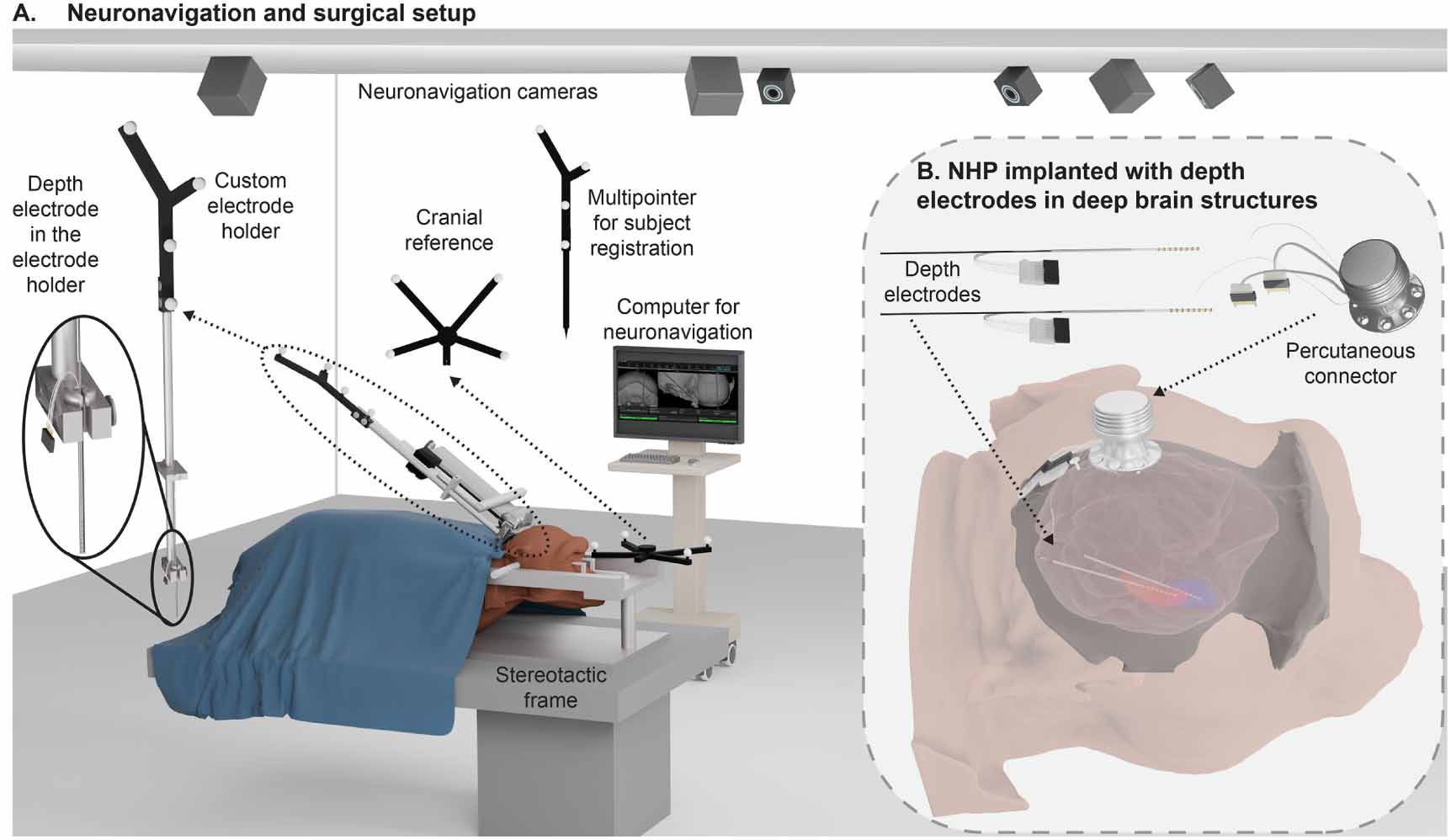 High-accuracy electrode implantation in deep brain structures using ...