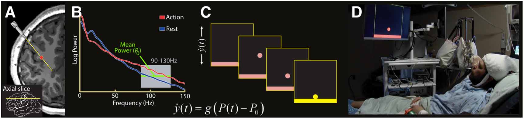 sEEG-based brain-computer interfacing in a large adult and pediatric ...