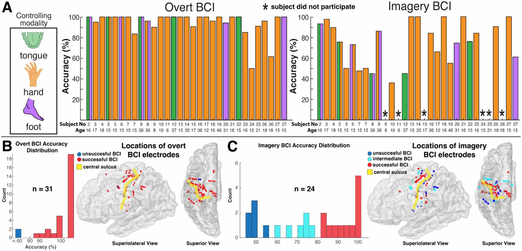 sEEG-based brain-computer interfacing in a large adult and pediatric ...