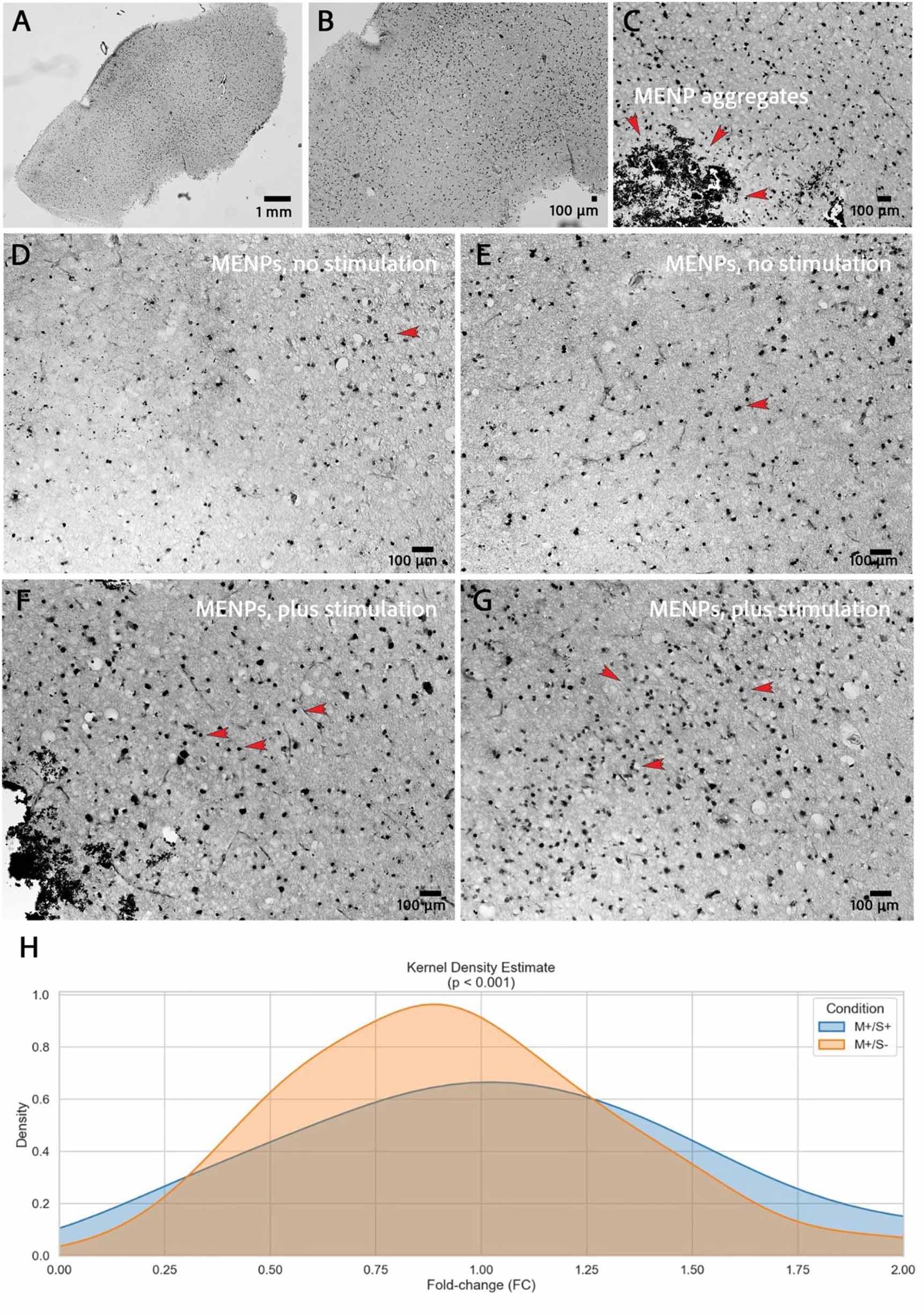 Organotypic human brain slice cultures as a translational testing ...