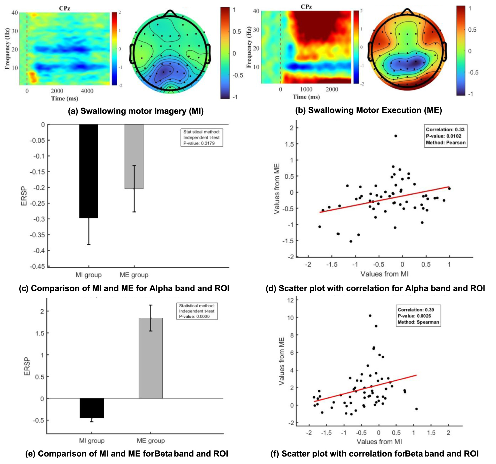 Neural correlation between swallowing motor imagery and execution: an ...