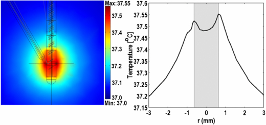 Temperature control at DBS electrodes using a heat sink: experimentally ...