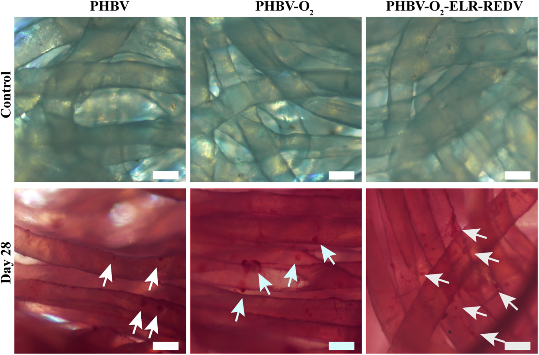 PHBV wet-spun scaffold coated with ELR-REDV improves vascularization ...