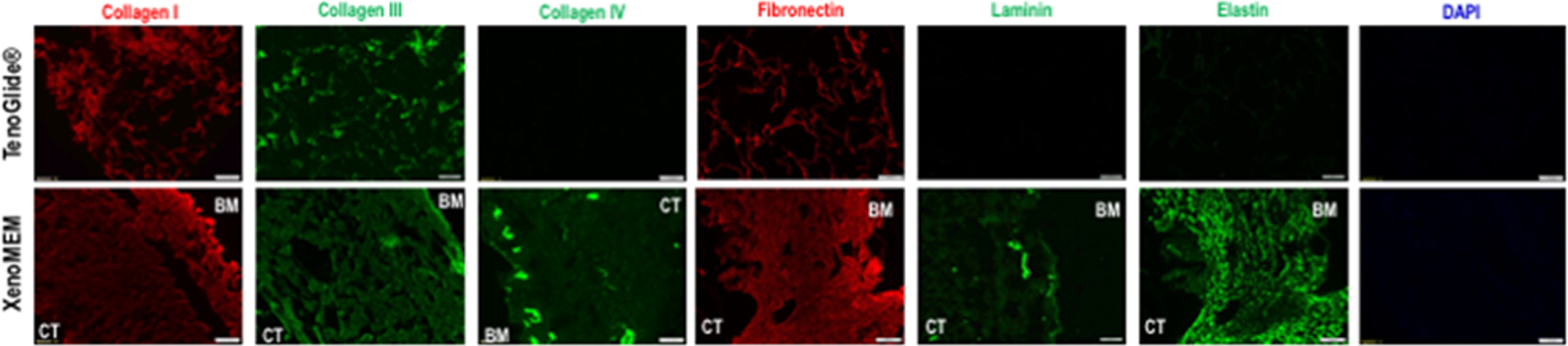 Decellularised porcine peritoneum as a tendon protector sheet - IOPscience