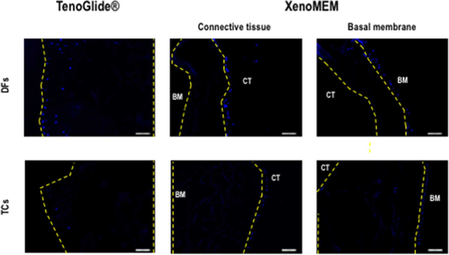 Decellularised porcine peritoneum as a tendon protector sheet - IOPscience
