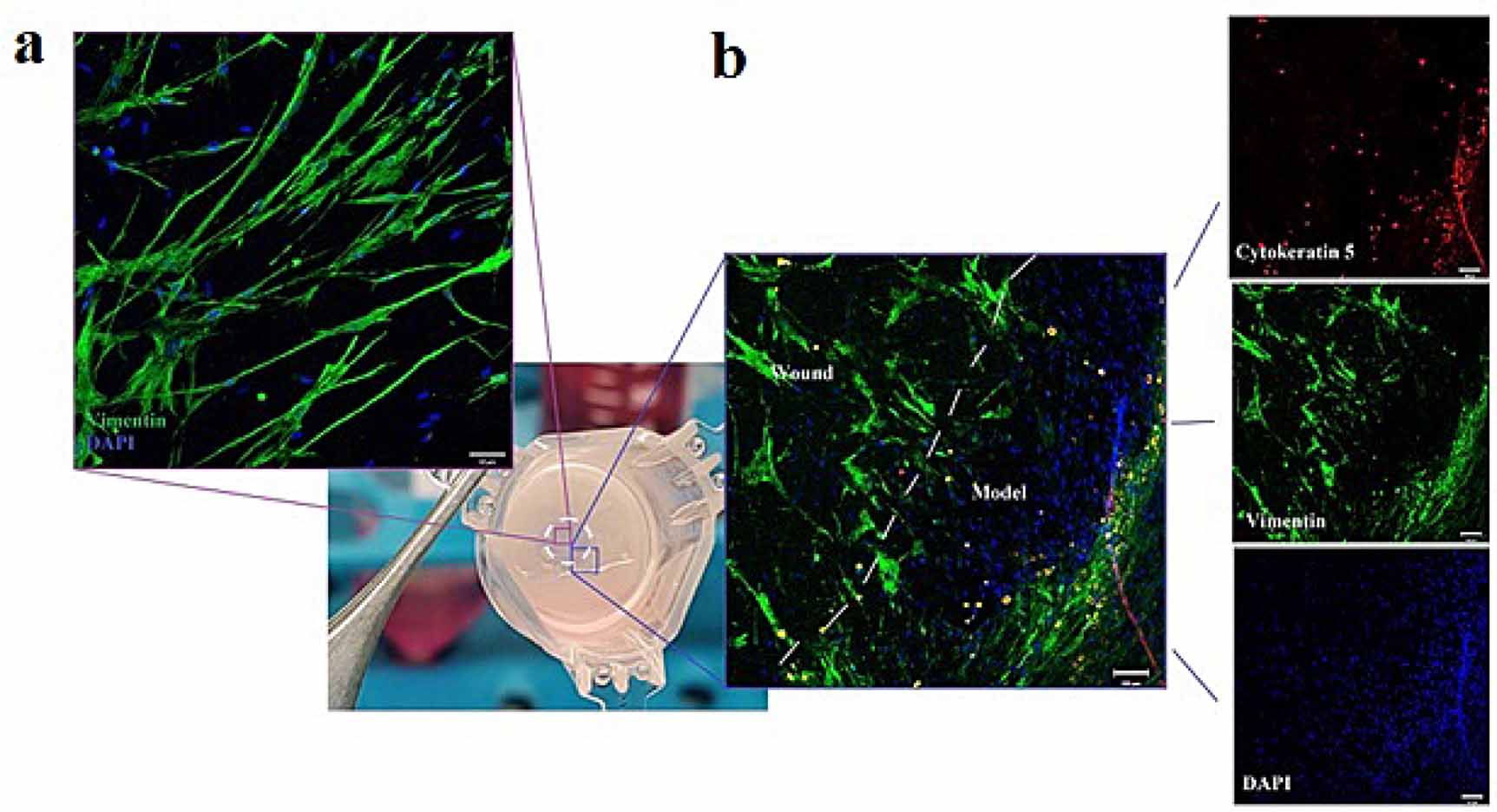 An in vitro 3D diabetic human skin model from diabetic primary cells ...