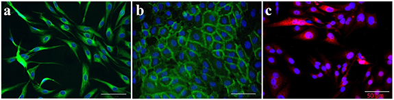 An in vitro 3D diabetic human skin model from diabetic primary cells ...