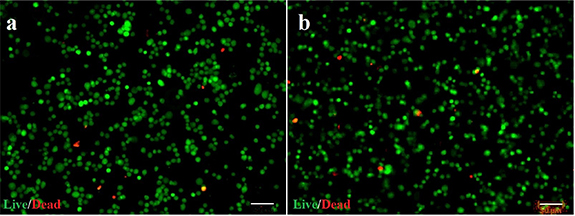 An in vitro 3D diabetic human skin model from diabetic primary cells ...