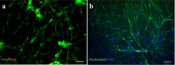 An in vitro 3D diabetic human skin model from diabetic primary cells ...