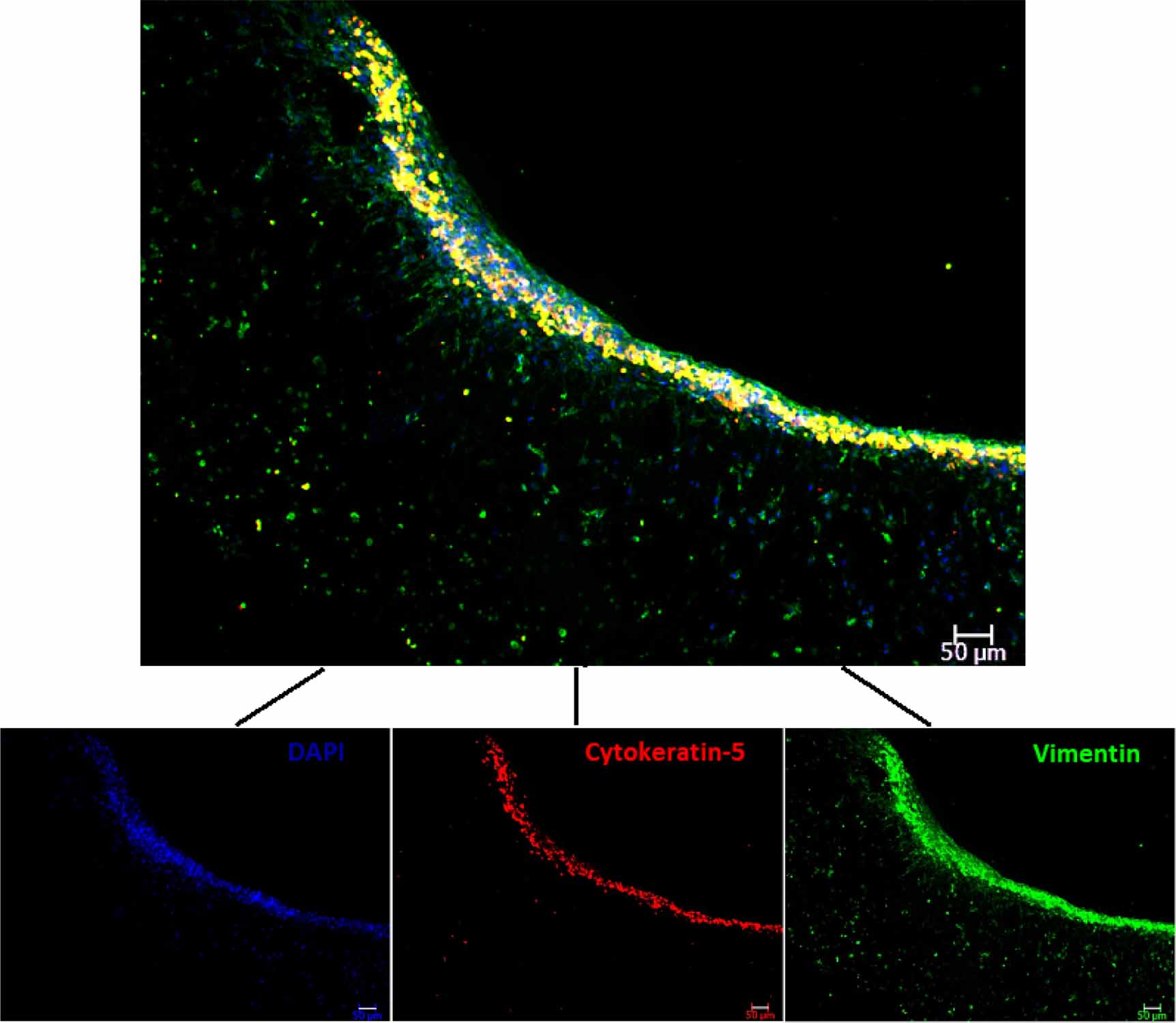 An in vitro 3D diabetic human skin model from diabetic primary cells ...