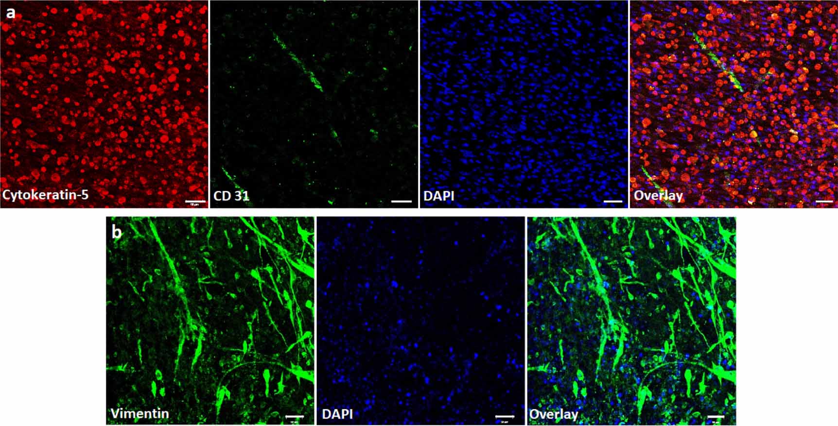 An in vitro 3D diabetic human skin model from diabetic primary cells ...