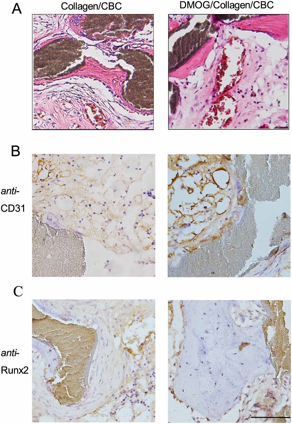 Delivery of dimethyloxalylglycine in calcined bone calcium scaffold to ...