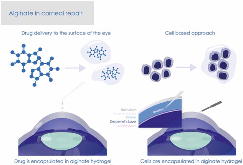 Alginate in corneal tissue engineering - IOPscience