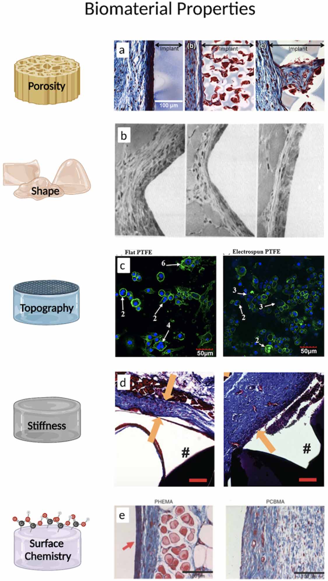 Foreign body response to synthetic polymer biomaterials and the role of ...