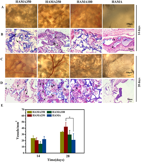Macroporous methacrylated hyaluronic acid hydrogel with different pore ...